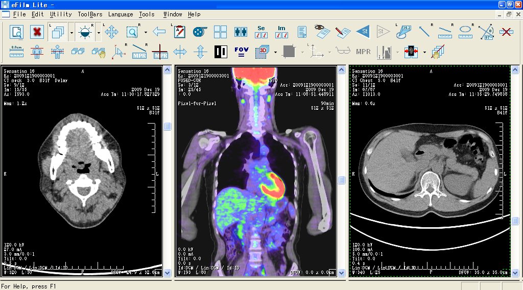 Efilmlt Back Pain: It's All About The Diagnosis
