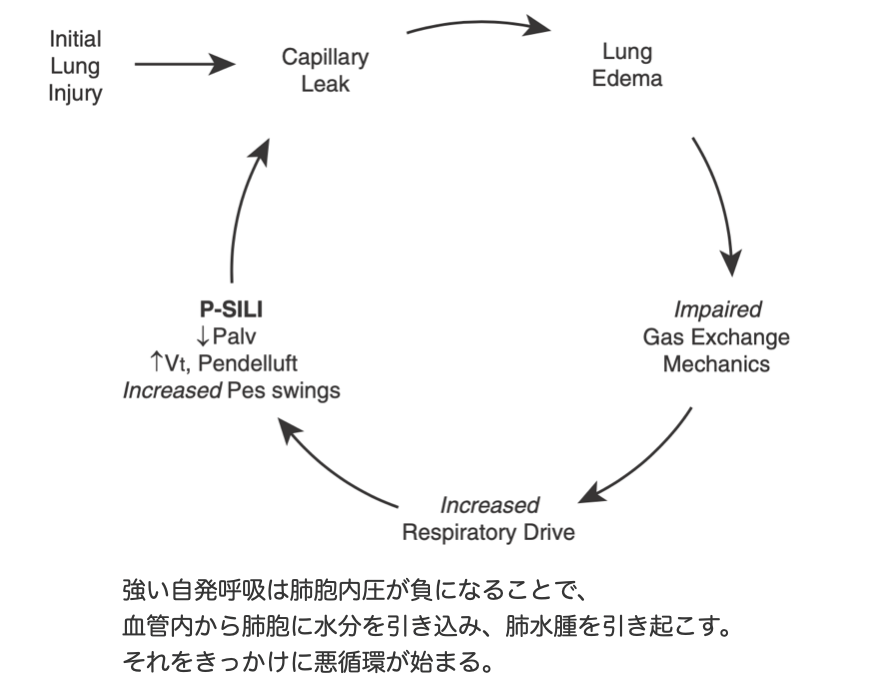 ICU備忘録 : patient self-inflicted lung injury