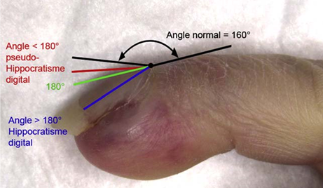 ICU備忘録 : 2019年11月09日