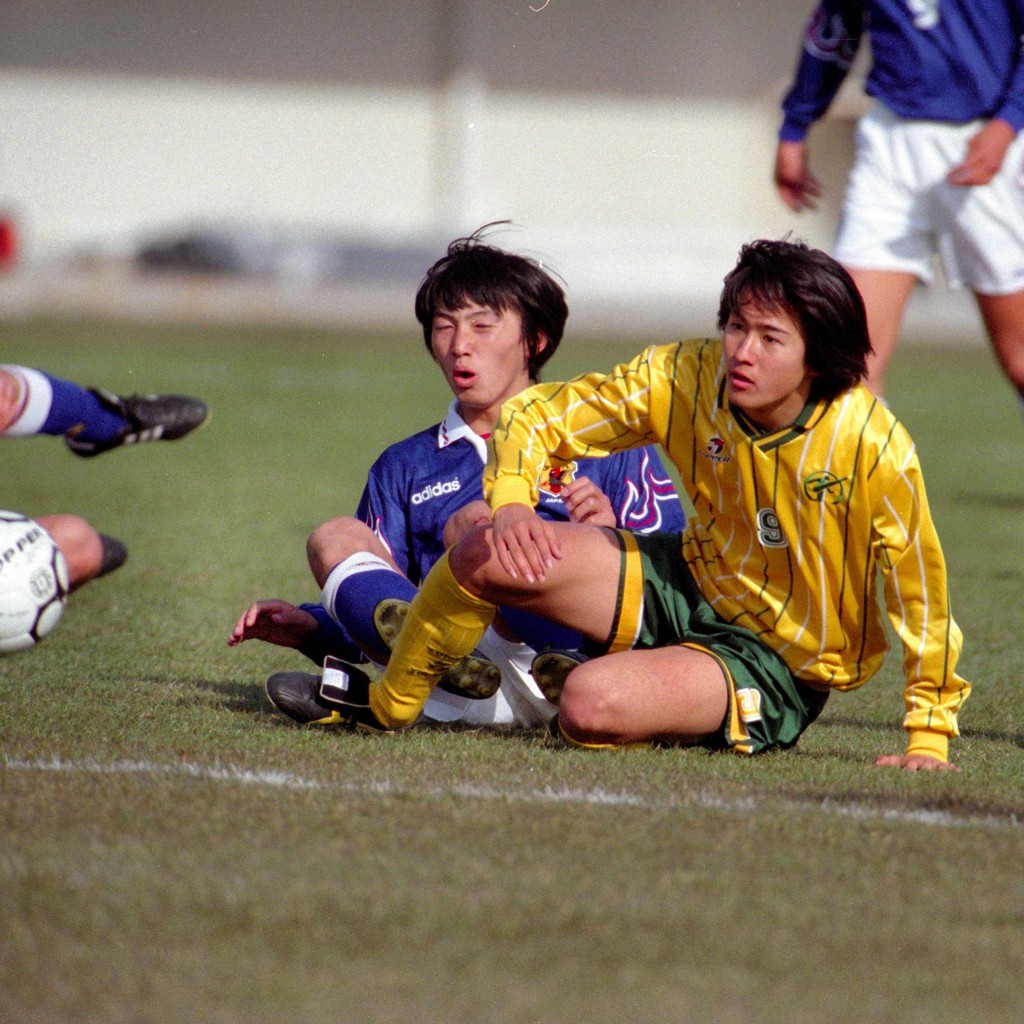 網膜剥離の眼が映し撮った写真