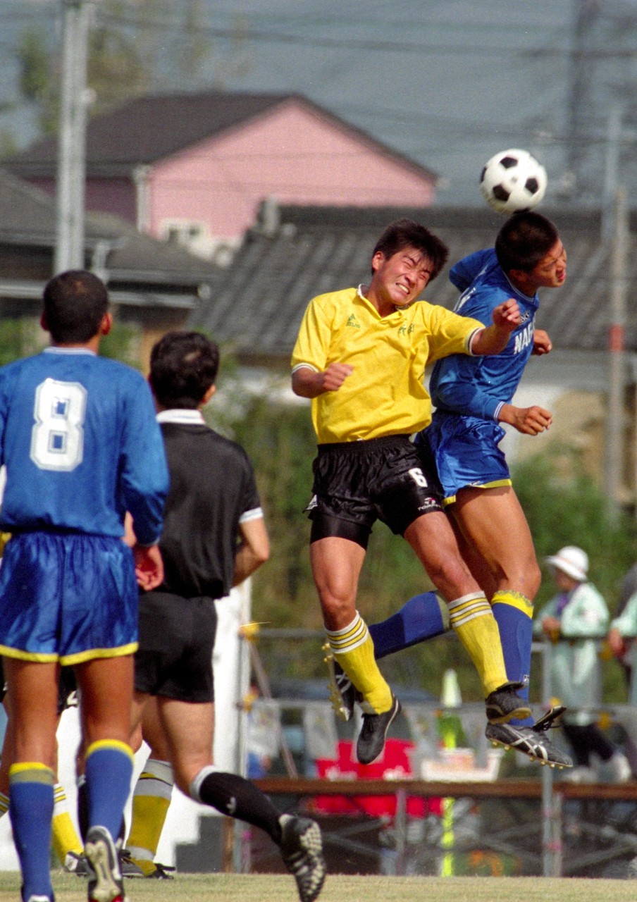 網膜剥離の眼が映し撮った写真