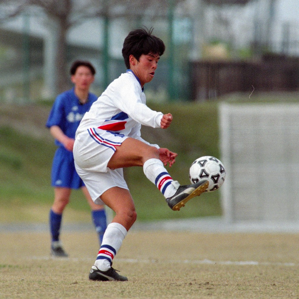 網膜剥離の眼が映し撮った写真