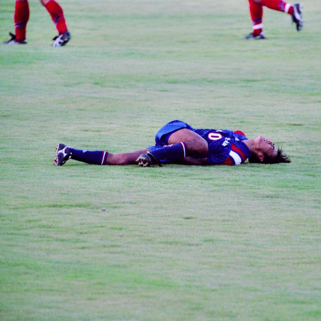 網膜剥離の眼が映し撮った写真