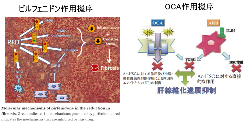 静かに深めるF351 NASH適応拡大への確信！〜メキシコからアイス♥を込めて♪の巻 : GNI グローバル中堅製薬会社への道