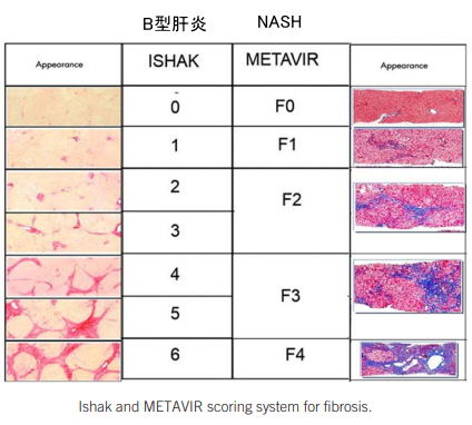 静かに深めるF351 NASH適応拡大への確信！〜メキシコからアイス♥を込めて♪の巻 : GNI グローバル中堅製薬会社への道