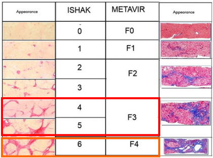 米国 F351 NASH ★メキシコ 試験精査、展望を探るの巻 : GNI グローバル中堅製薬会社への道