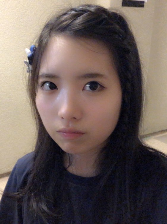 【画像】500万円費やし美容整形したAKBアイドル、激変にオタク衝撃！！ : 2chコピペ保存道場