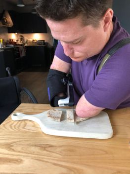 サイクルロード ～自転車への道／新しい人生を最大限に生きる｜ Alex-Lewis: Alex-Lewis-FLOAT: 義肢装具: 四肢切断 ...