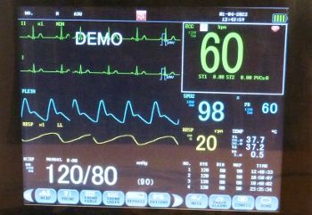 サイクルロード ～自転車への道／効果は疾患予防だけではない｜ 自転車エルゴメトリー: リハビリ: 集中治療室: ICU: 治療効果: