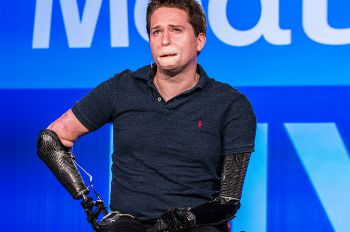 サイクルロード ～自転車への道／新しい人生を最大限に生きる｜ Alex-Lewis: Alex-Lewis-FLOAT: 義肢装具: 四肢切断 ...