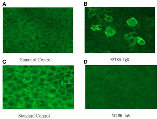 医学部の勉強 分子病理学 : ワクチン接種後末梢神経障害