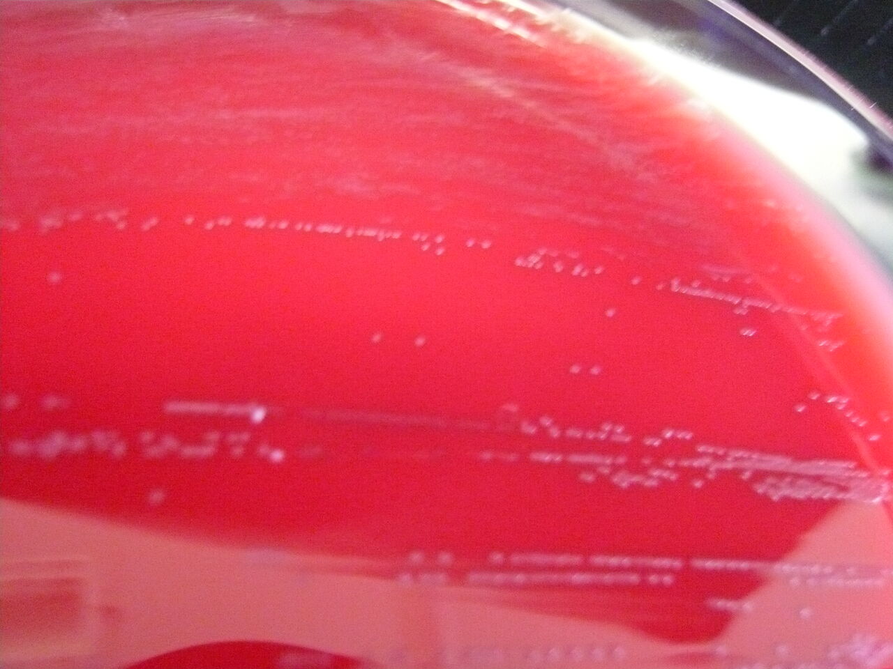 Streptococcus intermedius はアンギノーサス anginosus 菌群に含まれる口腔レンサ球菌 : 感染症の病理学的考え方