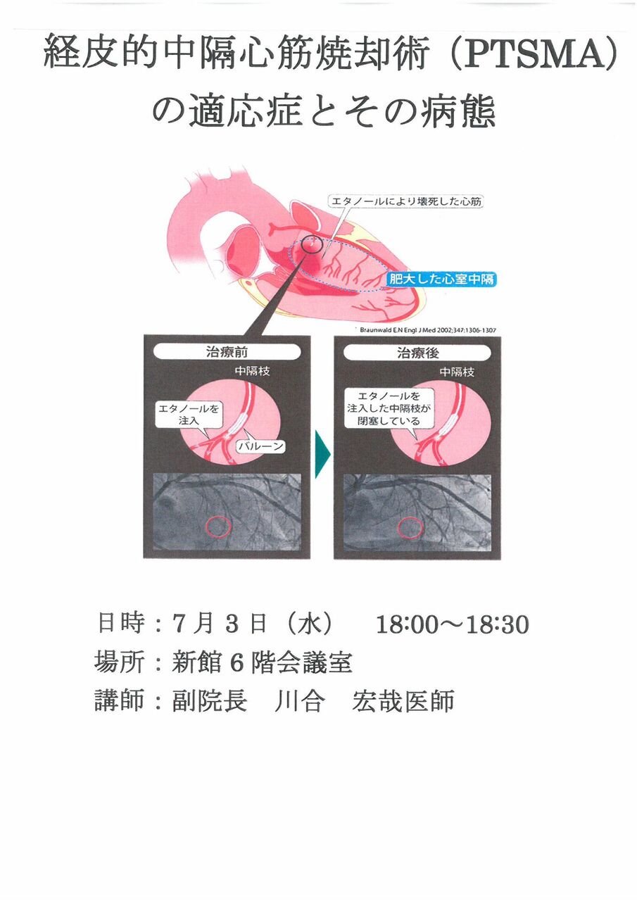 2013.7.3 経皮的中隔心筋焼灼術（PTSMA）の適応症とその病態 : はり姫 循内のblog