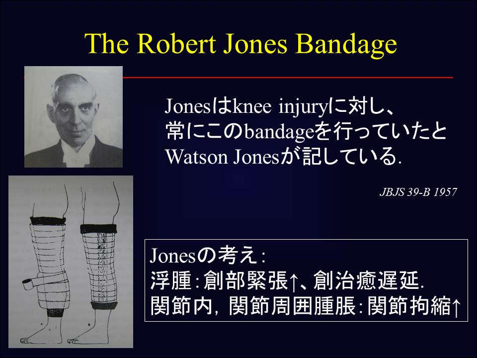 膝の手術後の包帯について(Jones dressing) : 膝関節鏡外科医のblog