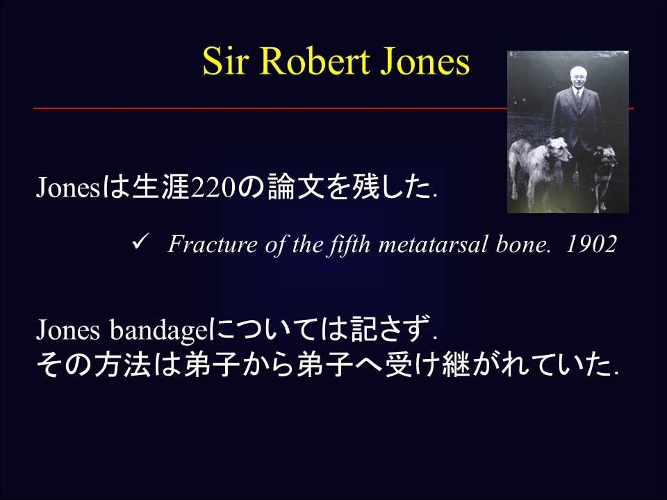 膝の手術後の包帯について(Jones dressing) : 膝関節鏡外科医のblog