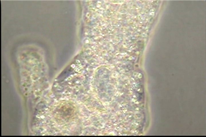 滴虫界 (Infusorian World）Ciliates，Amoebae，Flagellates，etc... : Amoeba proteus