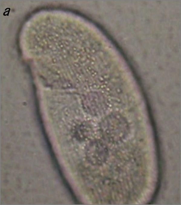 滴虫界 (Infusorian World）Ciliates，Amoebae，Flagellates，etc... : Colpidium ...