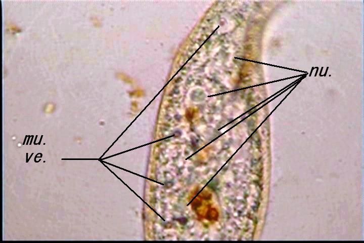滴虫界 (Infusorian World）Ciliates，Amoebae，Flagellates，etc... : Loxodes ...