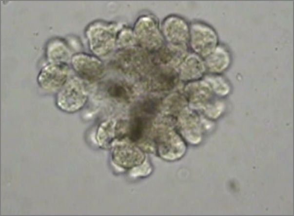 滴虫界 (Infusorian World）Ciliates，Amoebae，Flagellates，etc... : アメーバ状生物の多数分裂