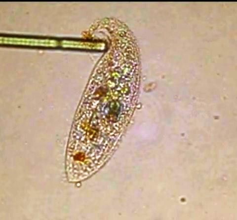 滴虫界 (Infusorian World）Ciliates，Amoebae，Flagellates，etc... : Loxodes ...