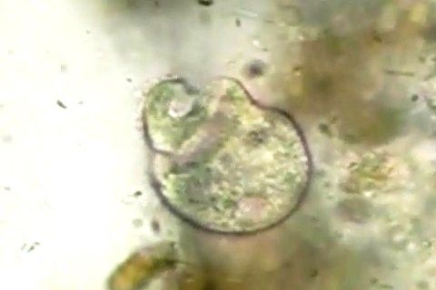 滴虫界 (Infusorian World）Ciliates，Amoebae，Flagellates，etc... : An unknown ...