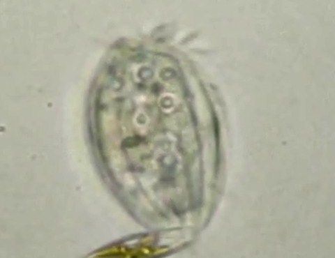 滴虫界 (Infusorian World）Ciliates，Amoebae，Flagellates，etc... : Euplotes ...