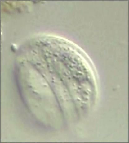滴虫界 (Infusorian World）Ciliates，Amoebae，Flagellates，etc... : Aspidisca ...