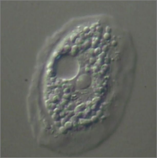 滴虫界 (Infusorian World）Ciliates，Amoebae，Flagellates，etc... : Hyalodiscus ...