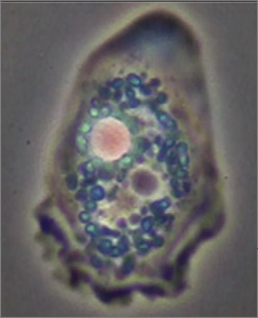 滴虫界 (Infusorian World）Ciliates，Amoebae，Flagellates，etc... : Hyalodiscus ...