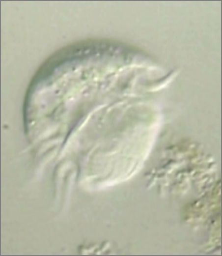 滴虫界 (Infusorian World）Ciliates，Amoebae，Flagellates，etc... : Aspidisca ...
