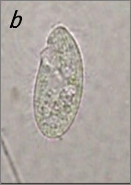 滴虫界 (Infusorian World）Ciliates，Amoebae，Flagellates，etc... : Colpidium ...