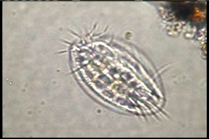 滴虫界 (Infusorian World）Ciliates，Amoebae，Flagellates，etc... : Euplotes ...