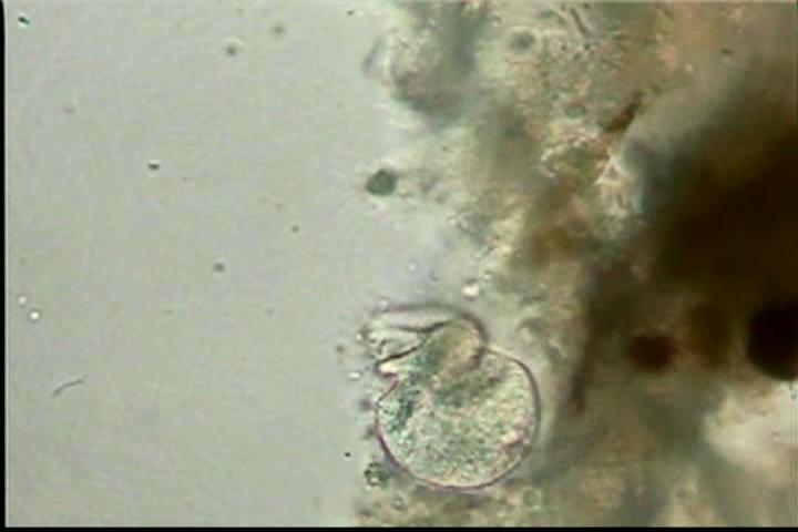 滴虫界 (Infusorian World）Ciliates，Amoebae，Flagellates，etc... : An unknown ...