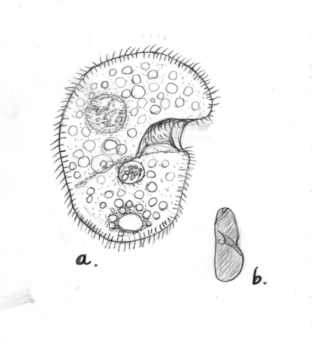 滴虫界 (Infusorian World）Ciliates，Amoebae，Flagellates，etc... : Colpoda ...