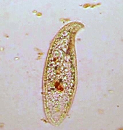 滴虫界 (Infusorian World）Ciliates，Amoebae，Flagellates，etc... : Loxodes ...