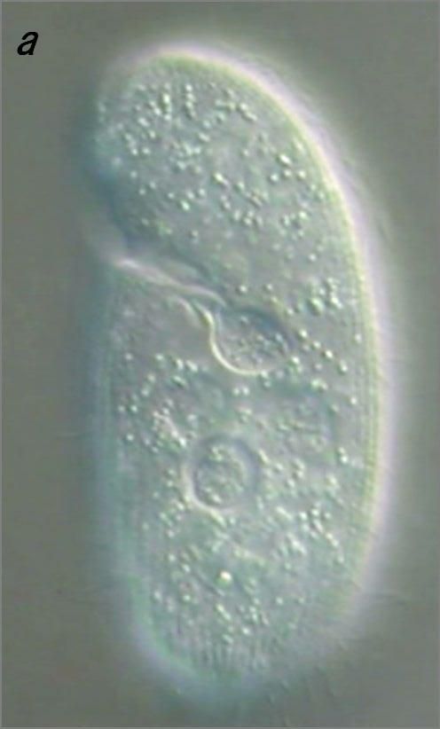 滴虫界 (Infusorian World）Ciliates，Amoebae，Flagellates，etc... : Colpidium ...