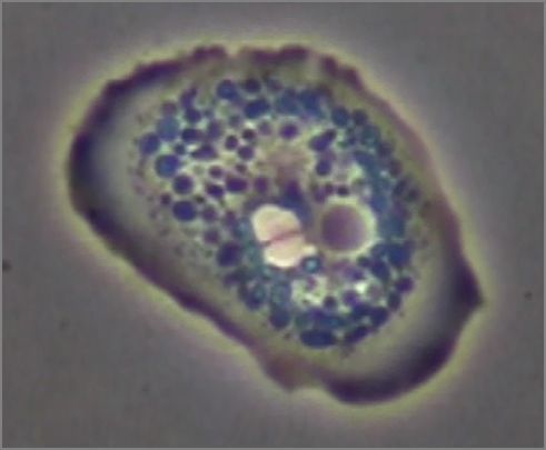 滴虫界 (Infusorian World）Ciliates，Amoebae，Flagellates，etc... : Hyalodiscus ...