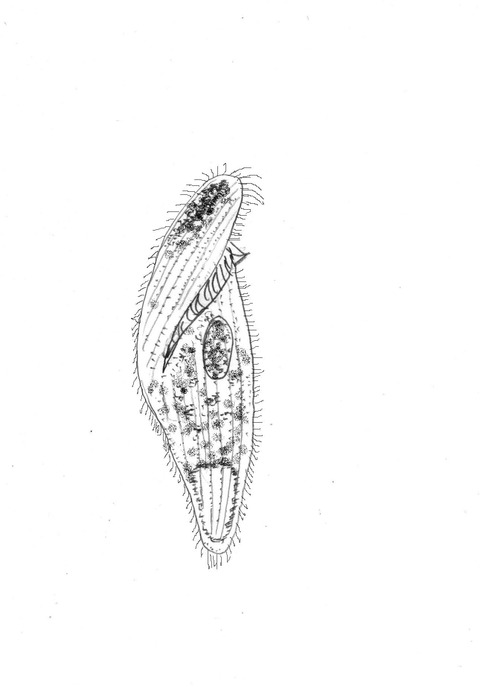 滴虫界 (Infusorian World）Ciliates，Amoebae，Flagellates，etc... : Metopus sp.