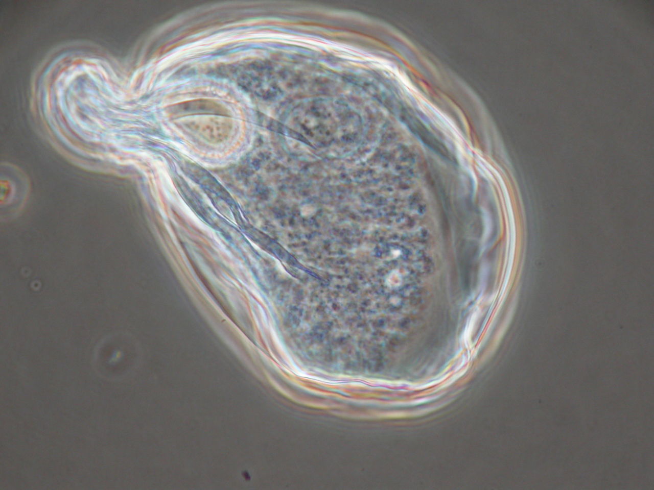 滴虫界 (Infusorian World）Ciliates，Amoebae，Flagellates，etc... : Amoebidaアメーバ目