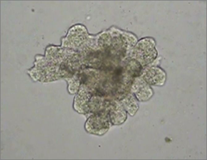 滴虫界 (Infusorian World）Ciliates，Amoebae，Flagellates，etc... : アメーバ状生物の多数分裂