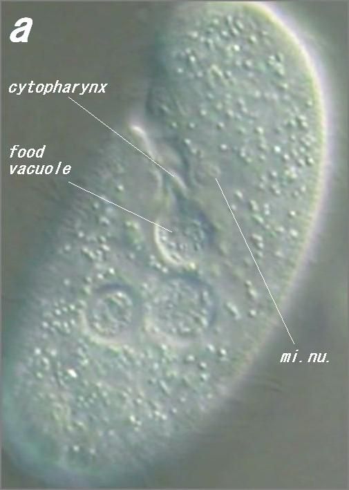 滴虫界 (Infusorian World）Ciliates，Amoebae，Flagellates，etc... : Colpidium ...