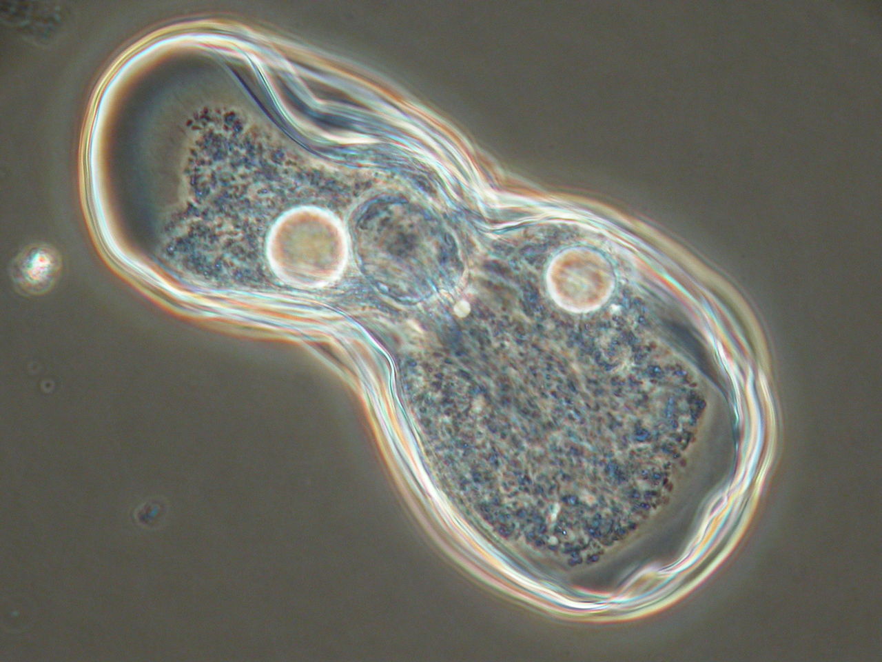 滴虫界 (Infusorian World）Ciliates，Amoebae，Flagellates，etc... : Amoebidaアメーバ目