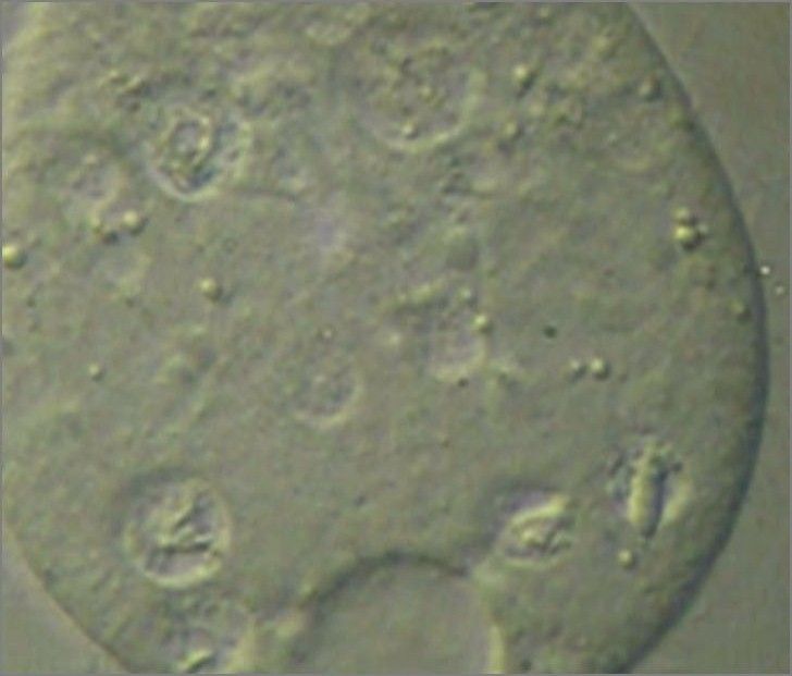 滴虫界 (Infusorian World）Ciliates，Amoebae，Flagellates，etc... : Colpoda ...