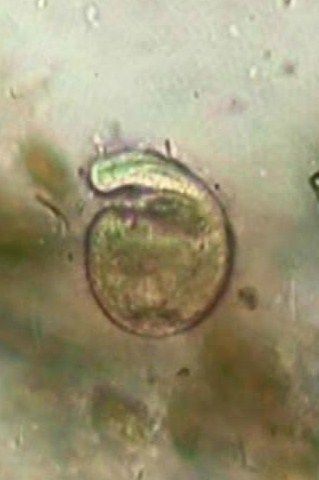 滴虫界 (Infusorian World）Ciliates，Amoebae，Flagellates，etc... : An unknown ...