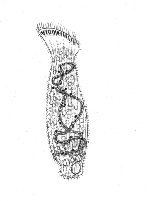 滴虫界 (Infusorian World）Ciliates，Amoebae，Flagellates，etc... : Spathidium ...