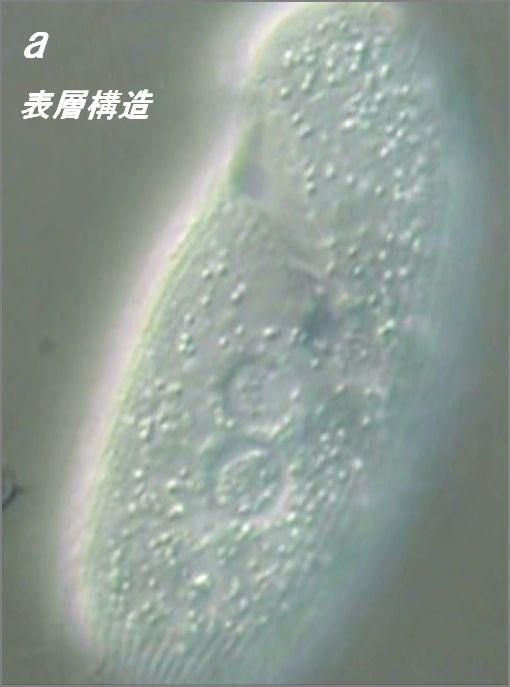 滴虫界 (Infusorian World）Ciliates，Amoebae，Flagellates，etc... : Colpidium ...