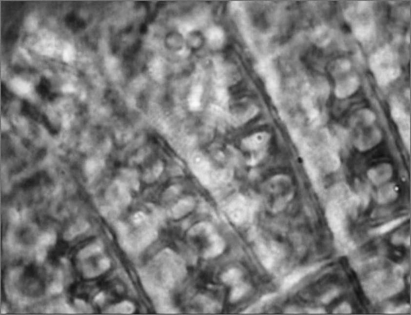 滴虫界 (Infusorian World）Ciliates，Amoebae，Flagellates，etc... : Coleps ...