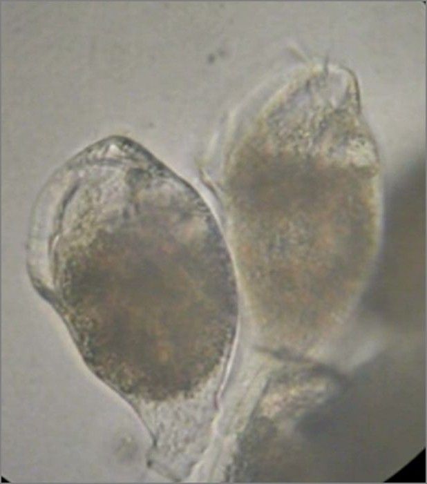 滴虫界 (Infusorian World）Ciliates，Amoebae，Flagellates，etc... : Epistylis ...