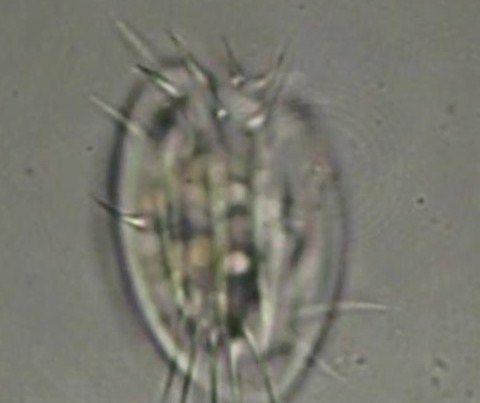 滴虫界 (Infusorian World）Ciliates，Amoebae，Flagellates，etc... : Euplotes ...