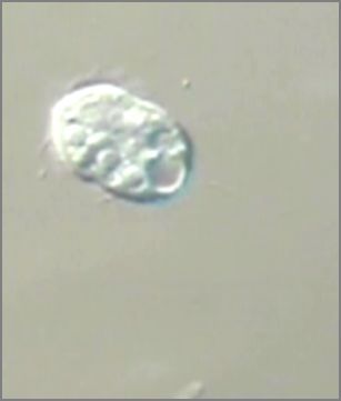 滴虫界 (Infusorian World）Ciliates，Amoebae，Flagellates，etc... : 小型繊毛虫